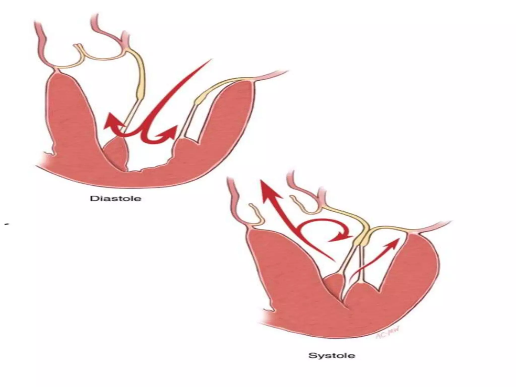 Mitral Valve Disease Pptx 3512
