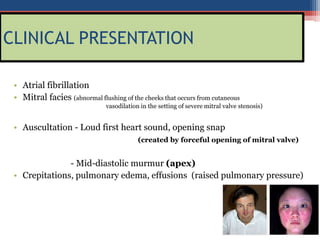Mitral valve disease 2020 | PPT
