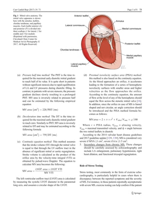Mitral Valve Disease a Comprehensive Review.pdf