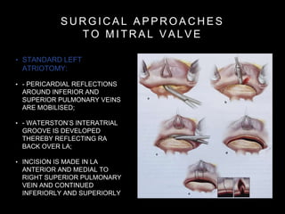 Mitral valve disease | PPTX