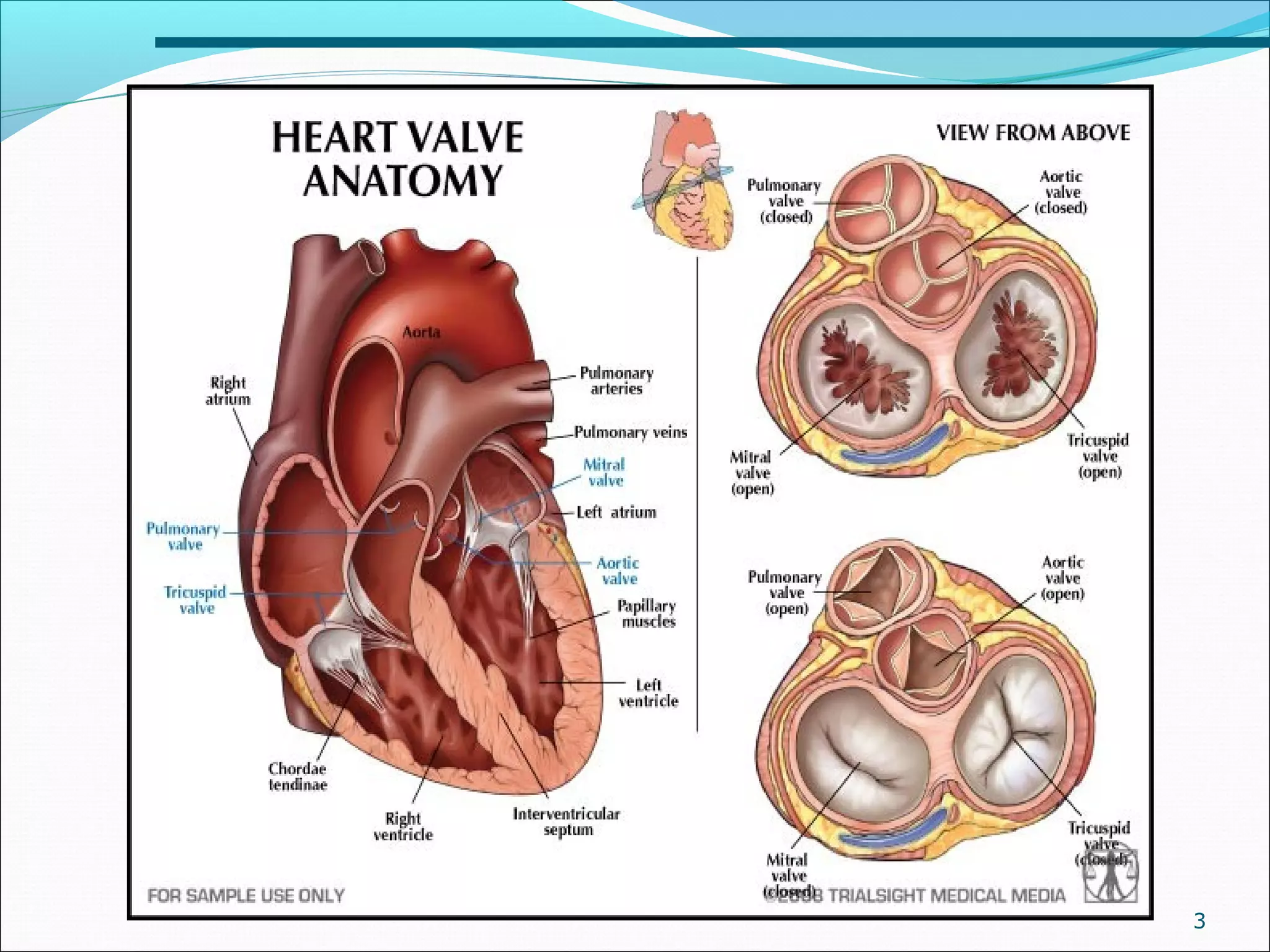 Mitral valve disorders | PPT