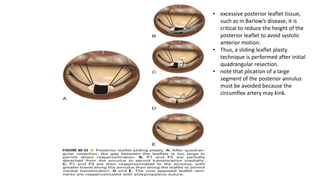 Mitral valve repair | PPTX