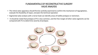 Mitral valve repair | PPTX
