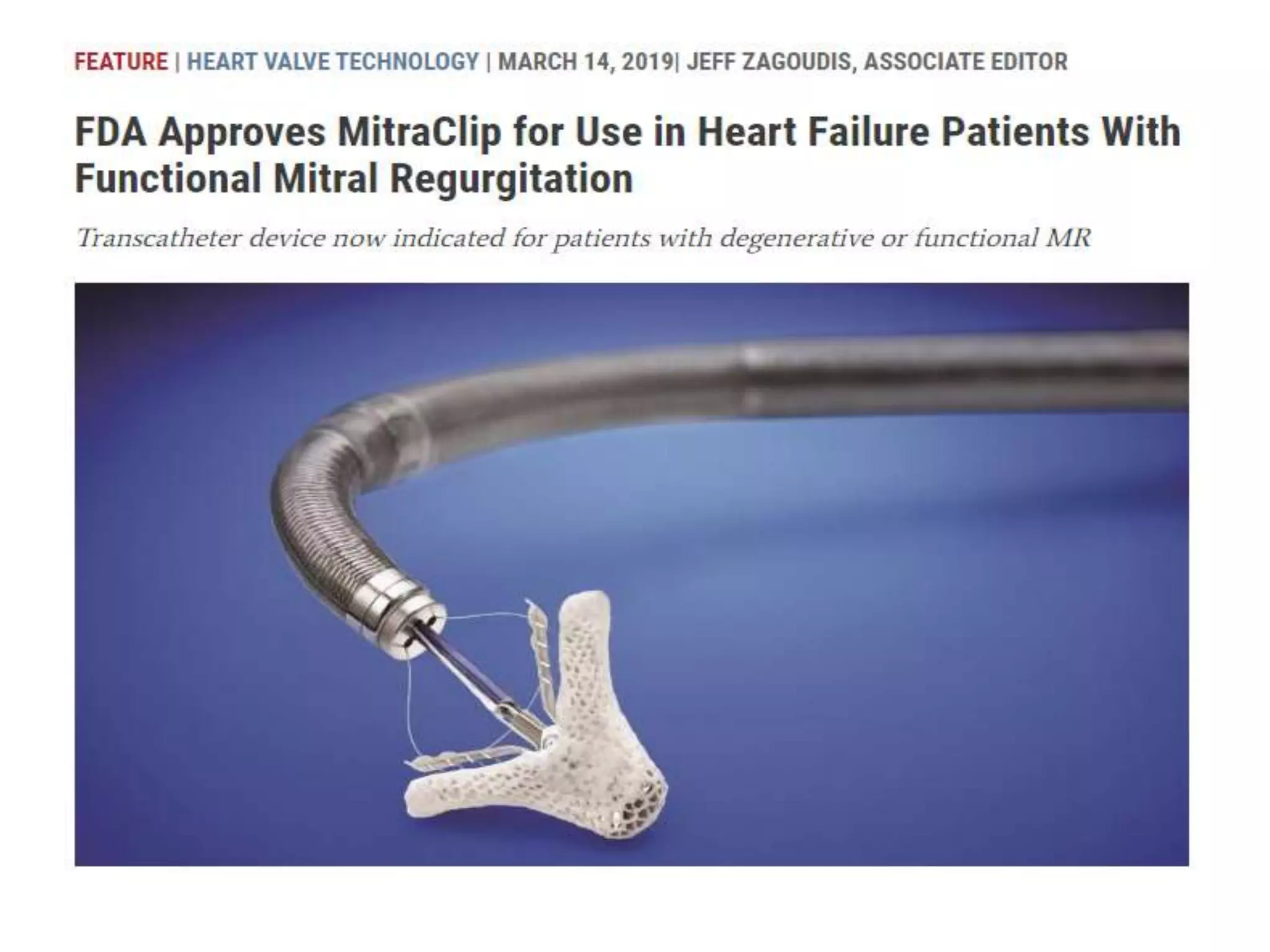Mitral valve repair//TRANSCATHETER MITRAL VALVE REPAIR/ TRANSCATHETER ...