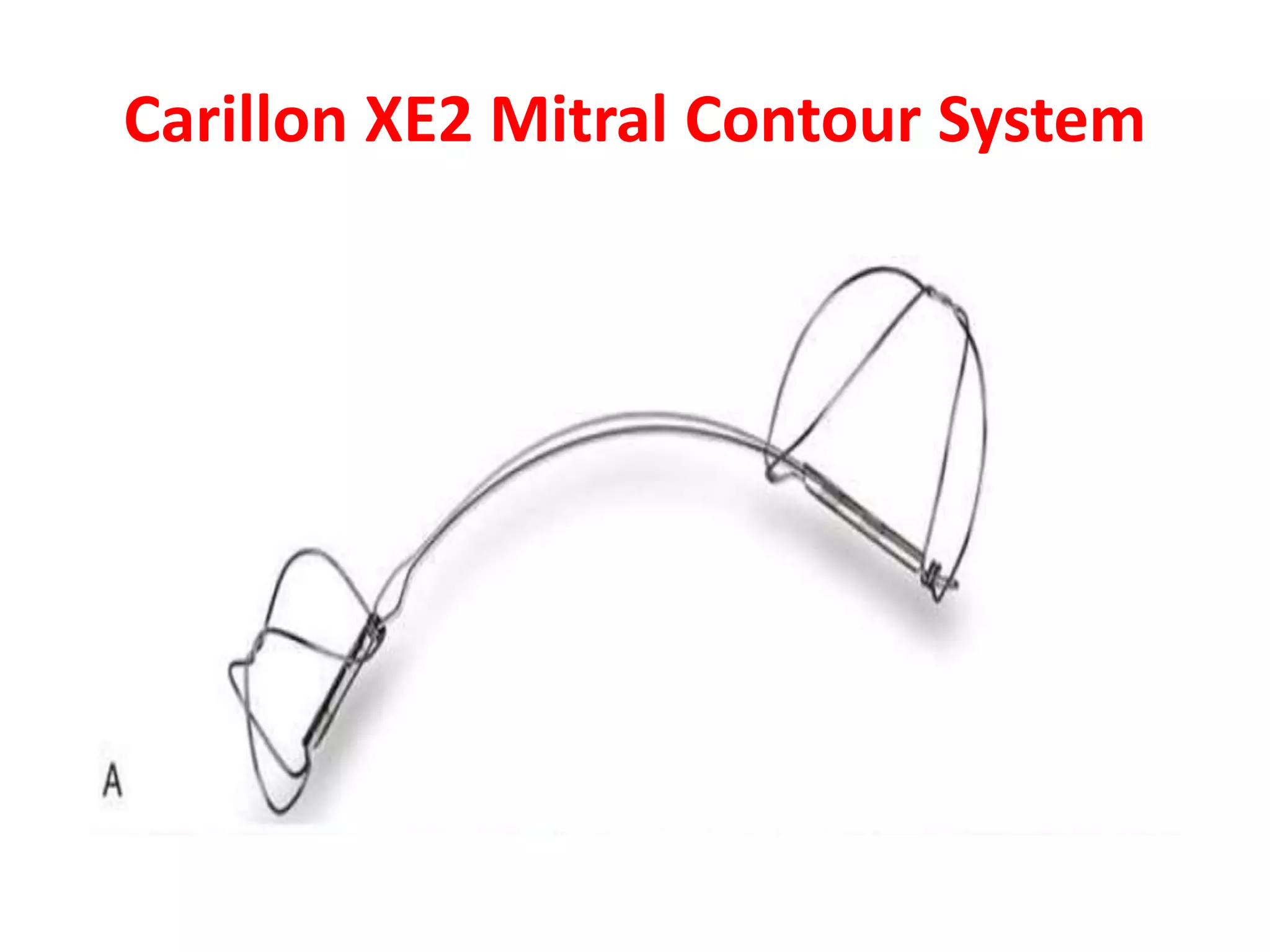 Mitral valve repair//TRANSCATHETER MITRAL VALVE REPAIR/ TRANSCATHETER ...