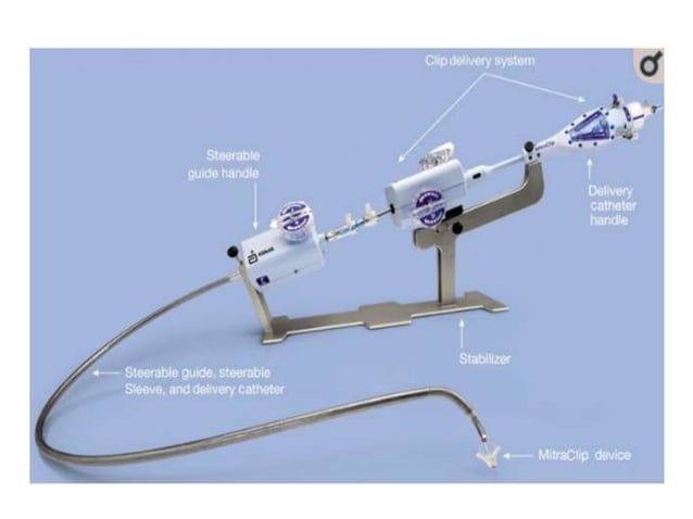 Mitral valve repair//TRANSCATHETER MITRAL VALVE REPAIR/ TRANSCATHETER ...