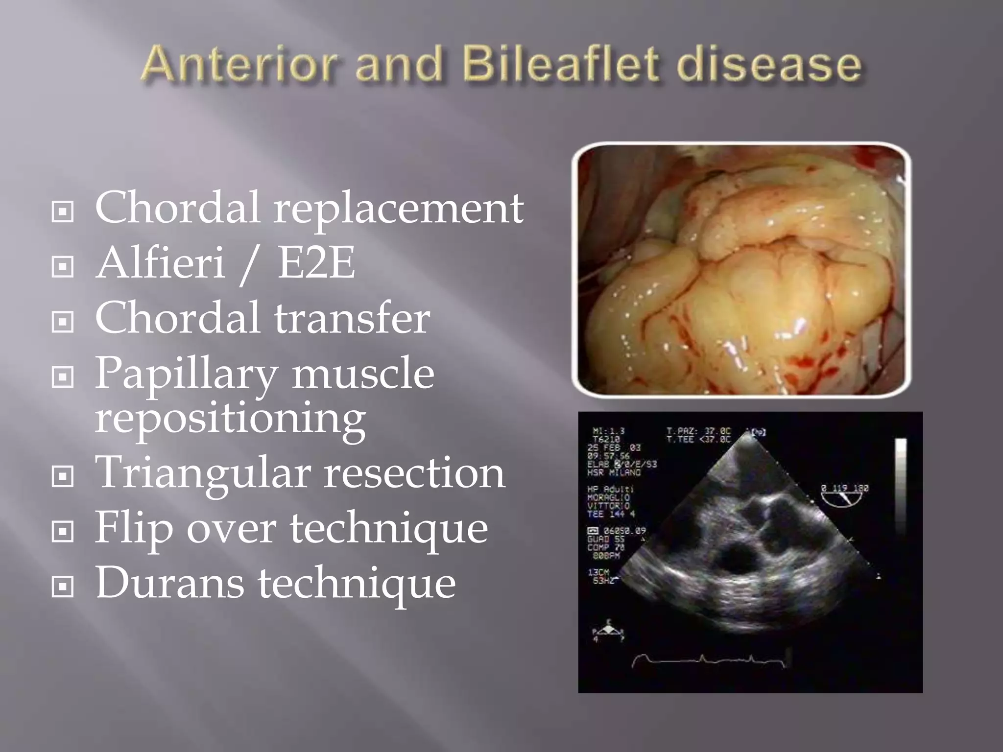 Mitral valve repair and related aspects | PPTX