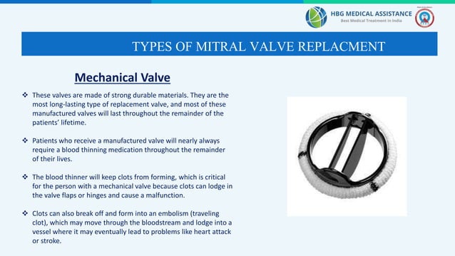 Mitral Valve Replacement Surgery in India | PPT