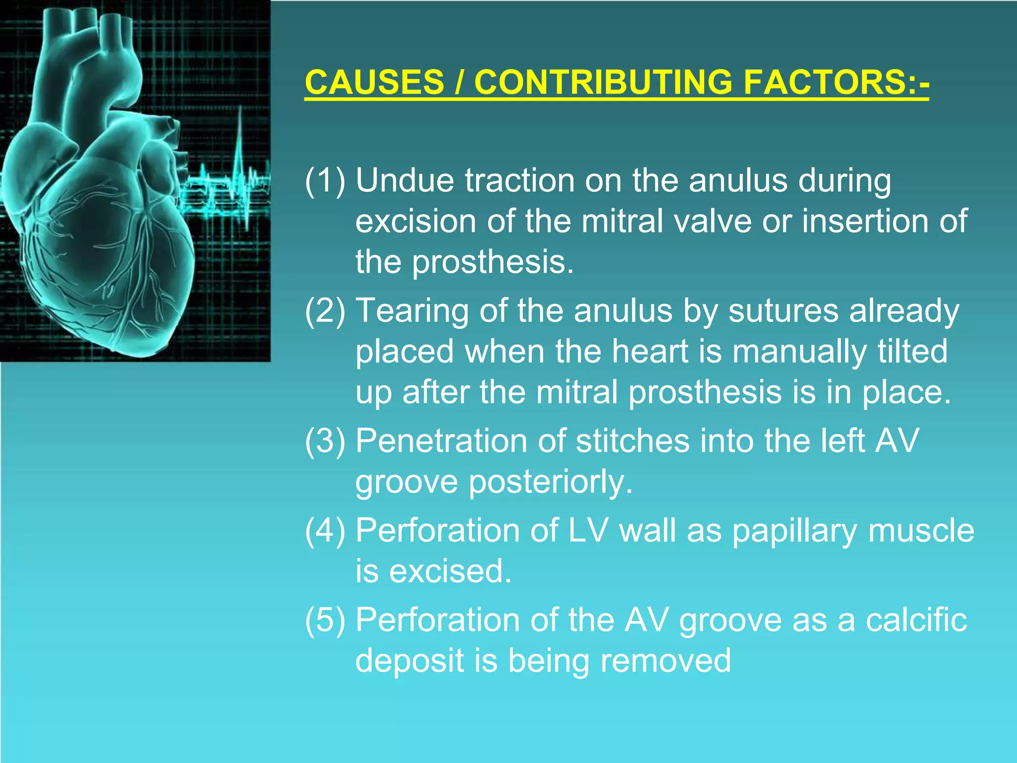 Complication of Mitral valve replacement surgery | PPTX