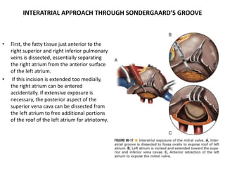 Mitral valve surgical treatment | PPTX