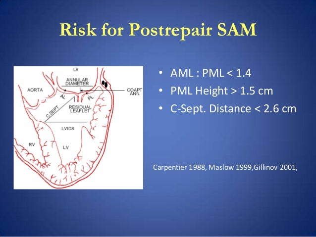Mitral valve tee2013(dr dharmesh)