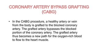 Myocardial infarction treatment | PPTX | Heart and Cardiovascular ...
