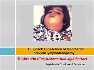 DIPHTHERIA 12032024. TUESDAY.pptx | Ear, Nose and Throat Conditions ...