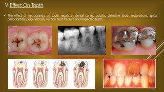gravity on oralcavity | PPTX