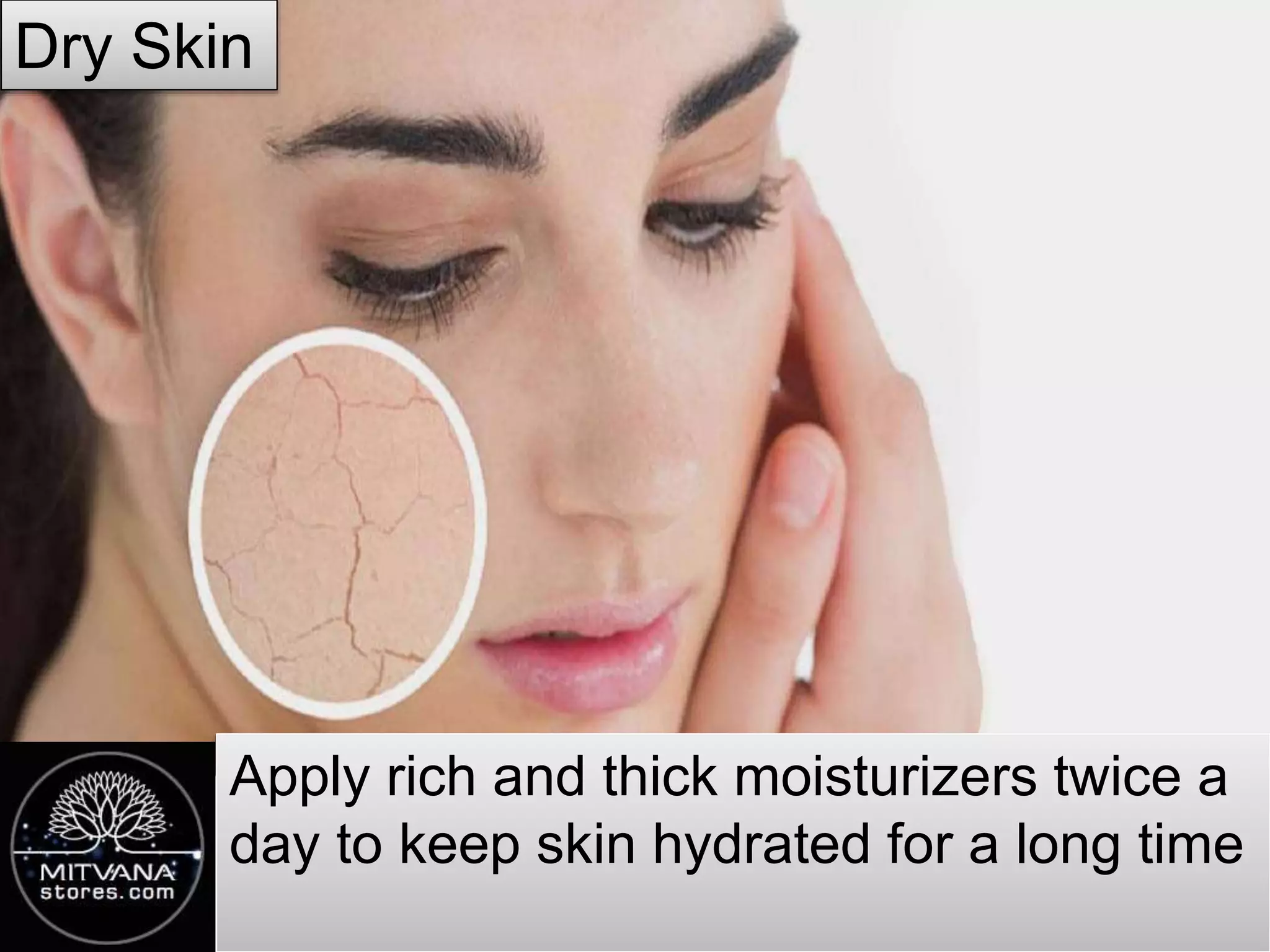 Skin types and How to treat them. | PPT