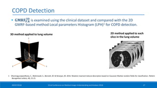 Volumetric Texture Analysis Based on Three-Dimensional Gaussian Markov Random Fields | PPTX