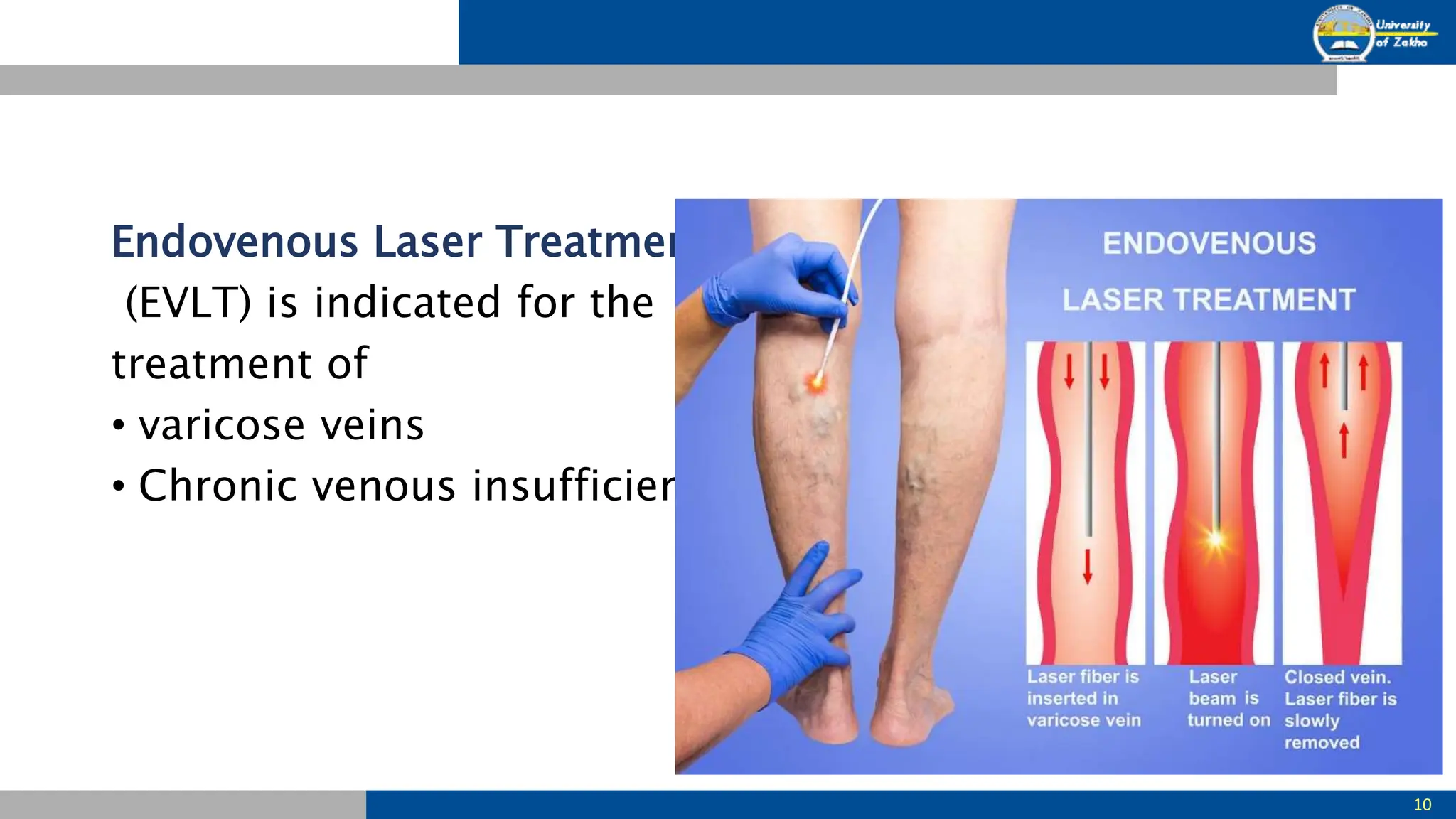 Minimal invasive vascular surgery | PPTX | Blood Disorders | Diseases ...