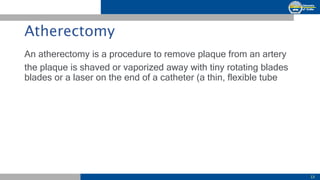 Minimal invasive vascular surgery | PPTX
