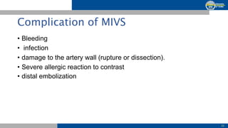Minimal invasive vascular surgery | PPTX