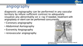 Minimal invasive vascular surgery | PPTX