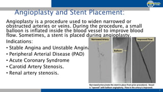 Minimal invasive vascular surgery | PPTX