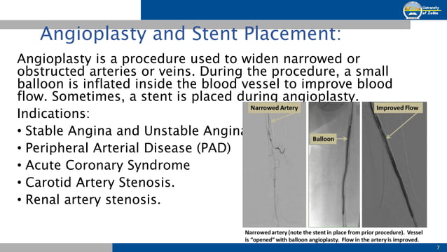 Minimal invasive vascular surgery | PPTX | Blood Disorders | Diseases ...