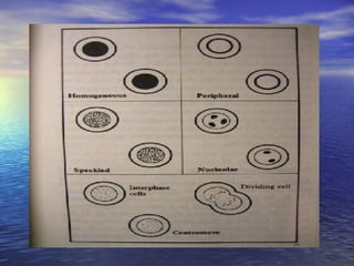 Mixed Connective Tissure Disease | PPT