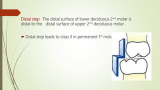 Mixed dention ppt | PPTX