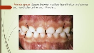 Mixed dention ppt | PPTX