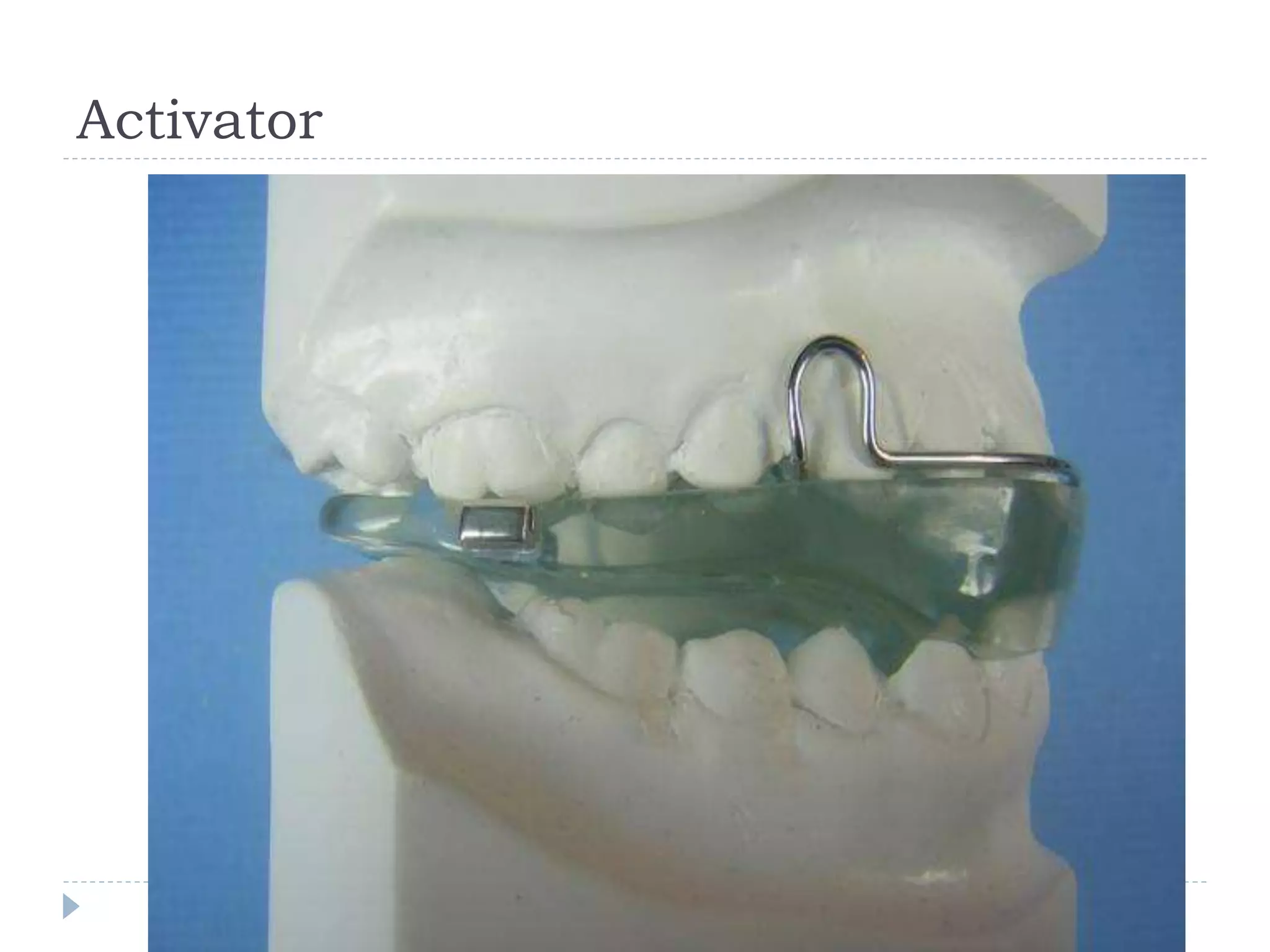 Introduction to Orthodontic treatment in Mixed dentition | PPTX