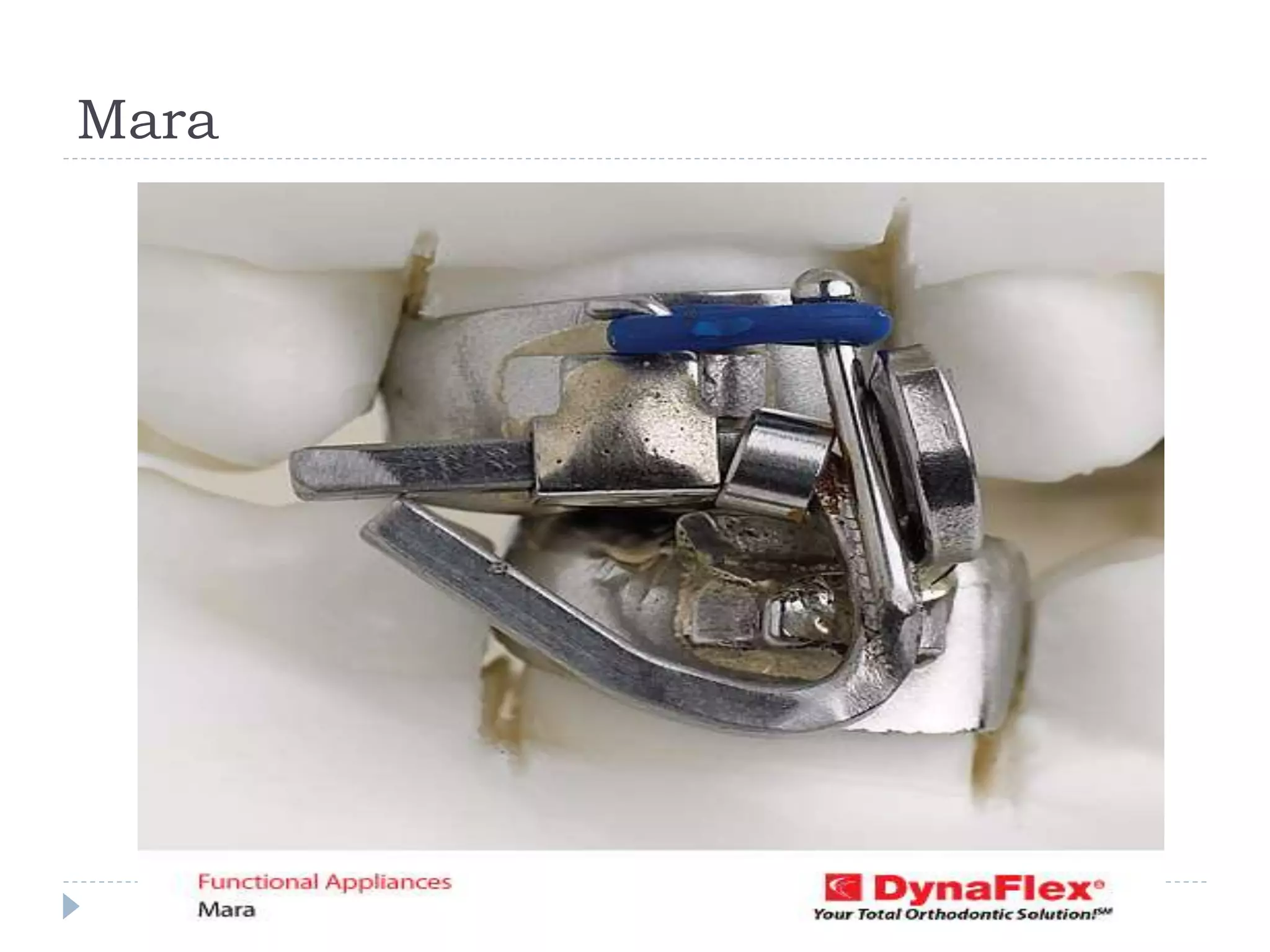 Introduction to Orthodontic treatment in Mixed dentition | PPTX