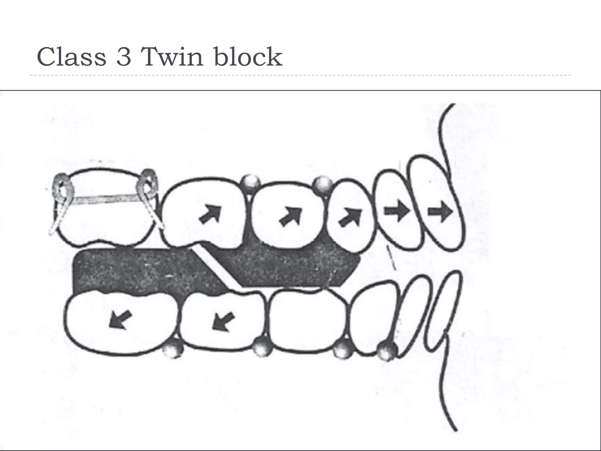 Introduction to Orthodontic treatment in Mixed dentition | PPTX