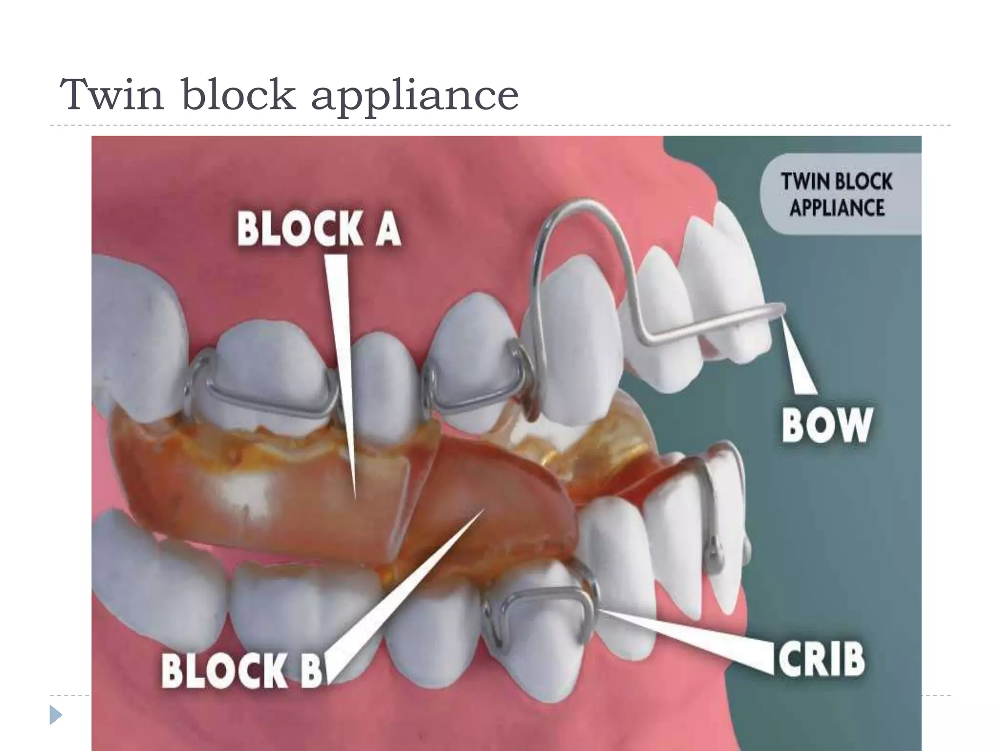 Introduction to Orthodontic treatment in Mixed dentition | PPTX