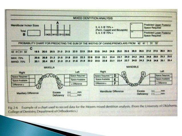 Mixed dentition analysis | PPTX | Dental Health | Diseases and Conditions