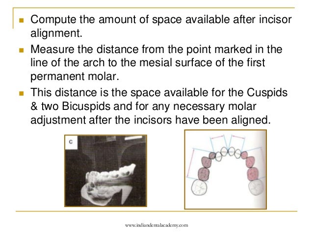 Mixed dentition analysis. /certified fixed orthodontic courses by Ind…