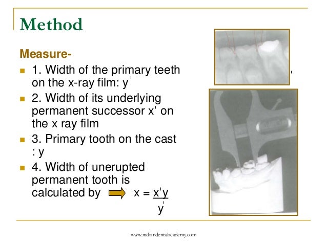 Mixed dentition analysis. /certified fixed orthodontic courses by Ind…