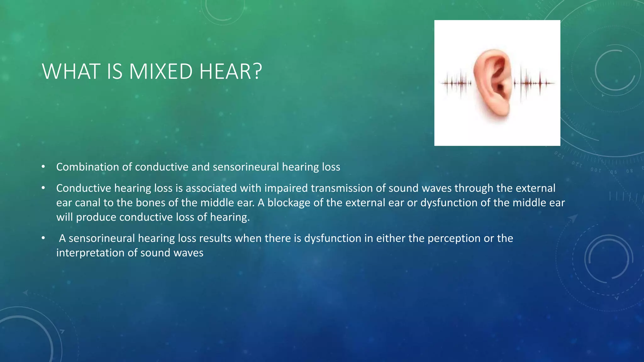 Mixed hearing | PPT