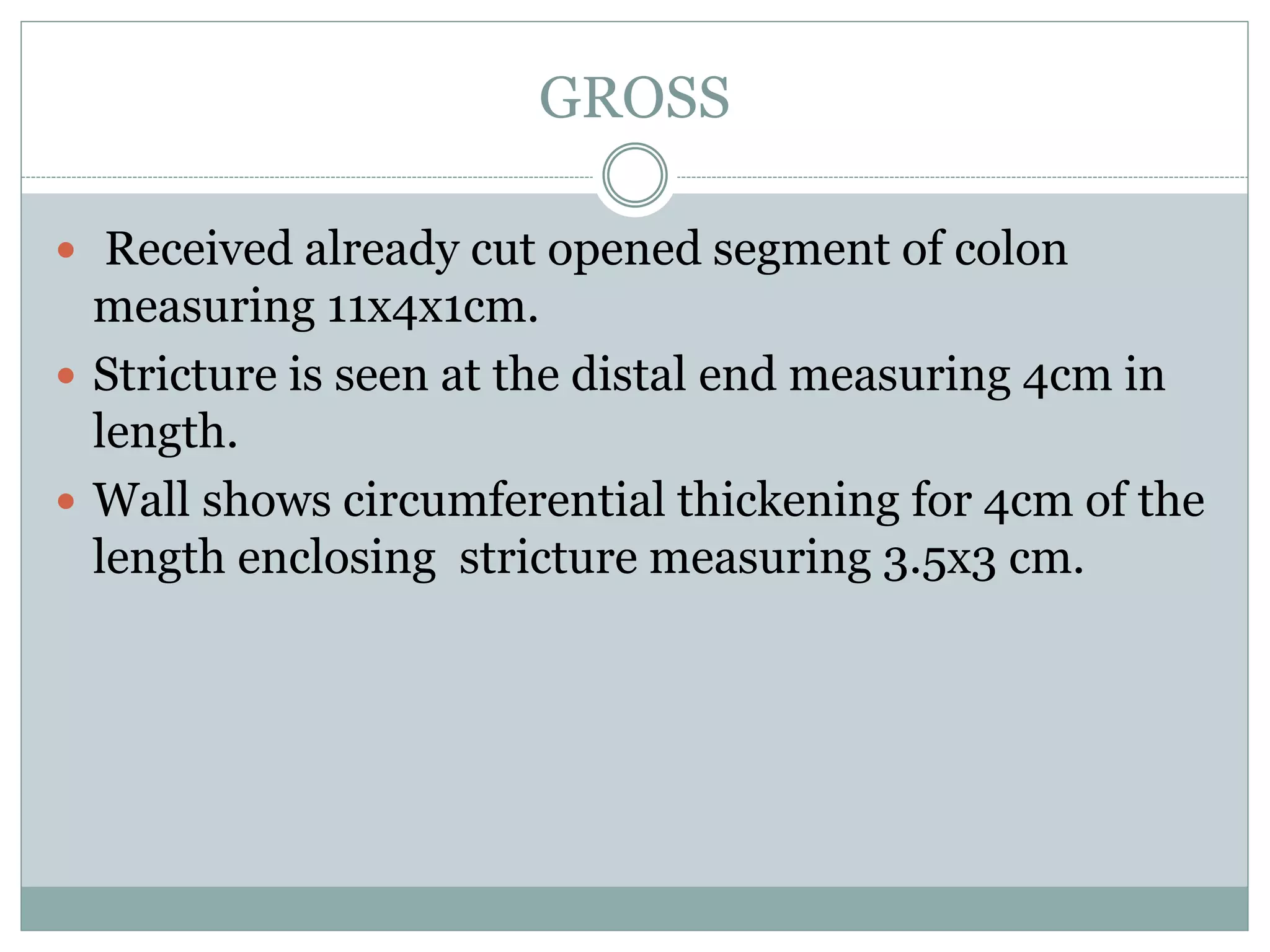 Mixed mucinous signet ring ca colon | PPTX