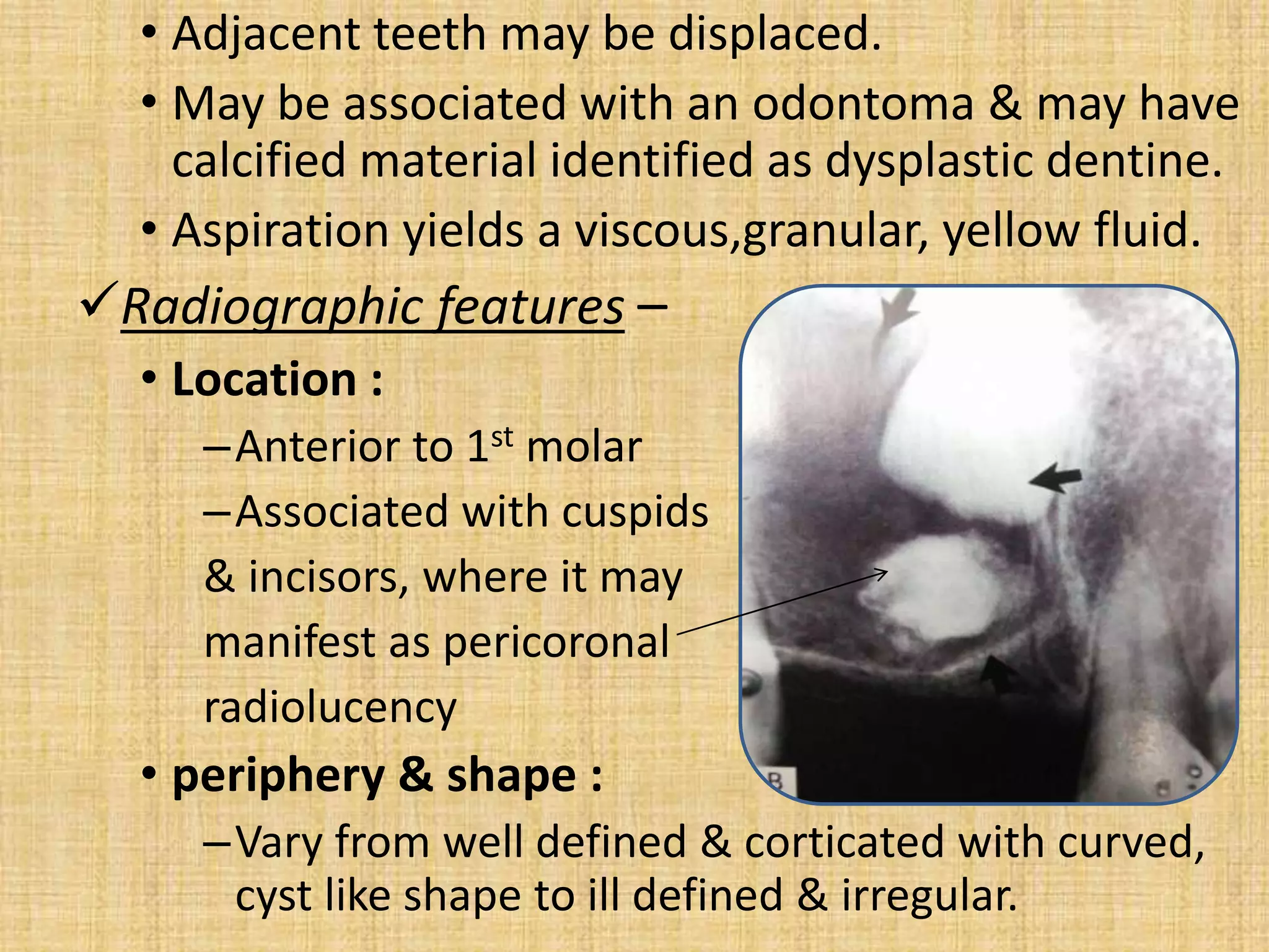 Mixed Radiopaque And Radiolucent Lesions Of Jaw Pptx