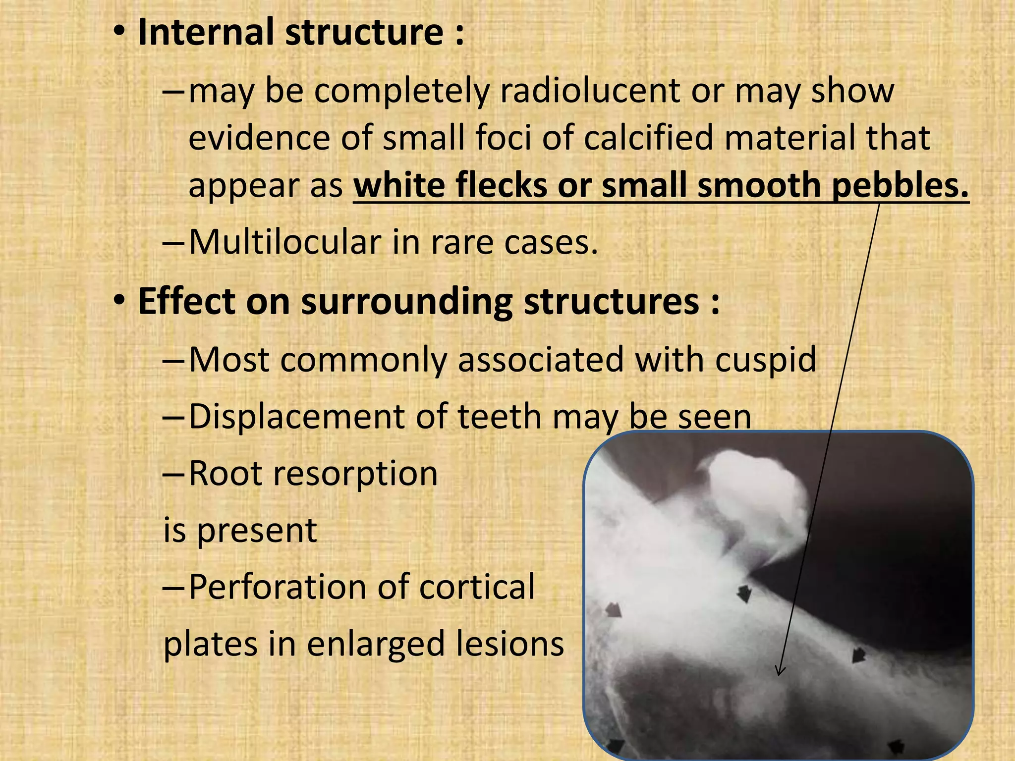 Mixed radiopaque & radiolucent lesions of jaw | PPTX