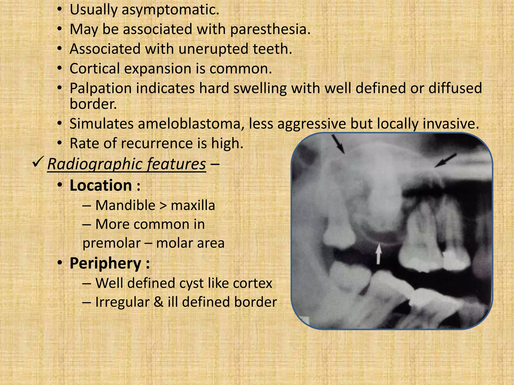 Mixed radiopaque & radiolucent lesions of jaw | PPTX