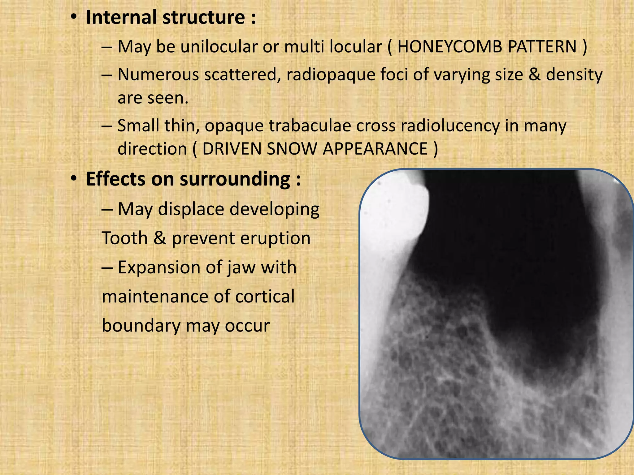Mixed radiopaque & radiolucent lesions of jaw | PPTX