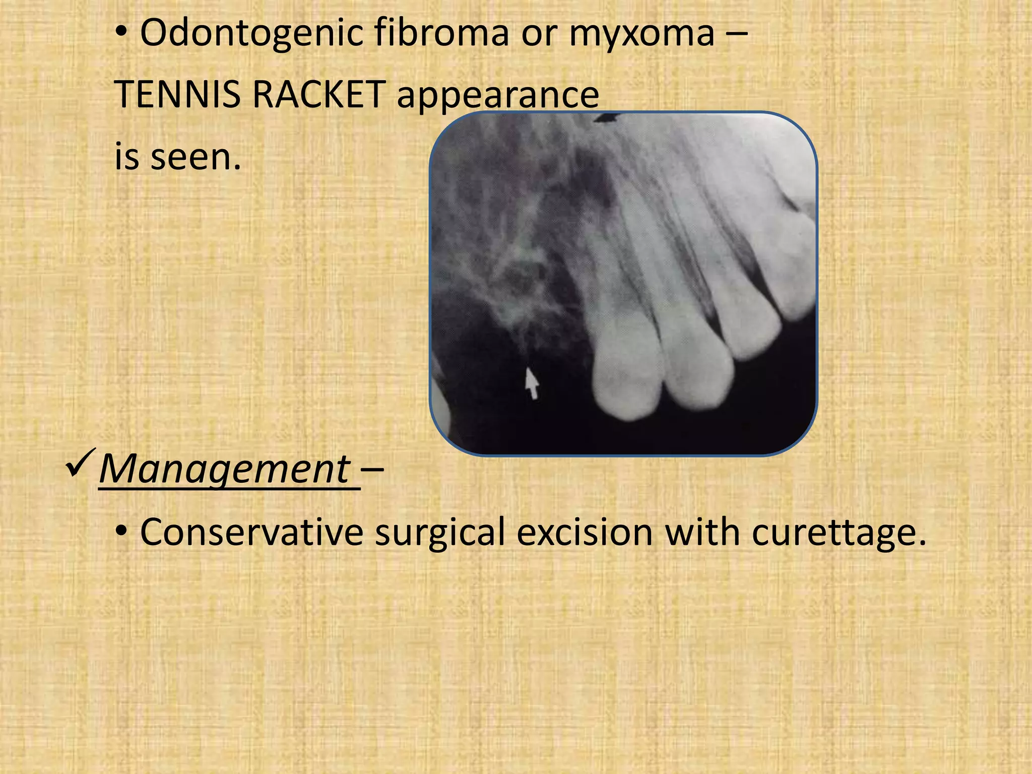 Mixed Radiopaque And Radiolucent Lesions Of Jaw Pptx