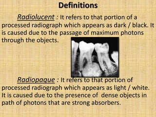 Mixed radiopaque & radiolucent lesions of jaw | PPT