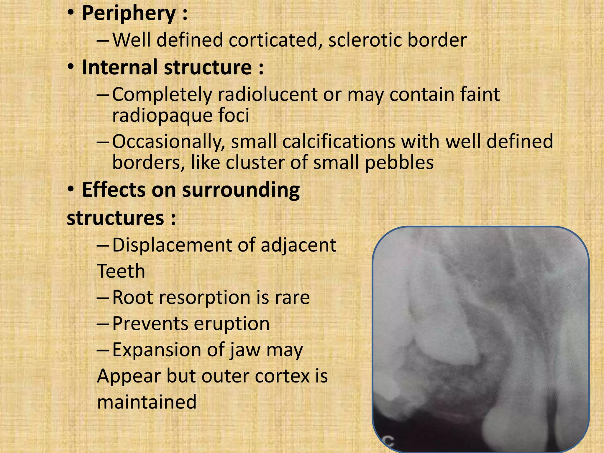 Mixed radiopaque & radiolucent lesions | PPTX