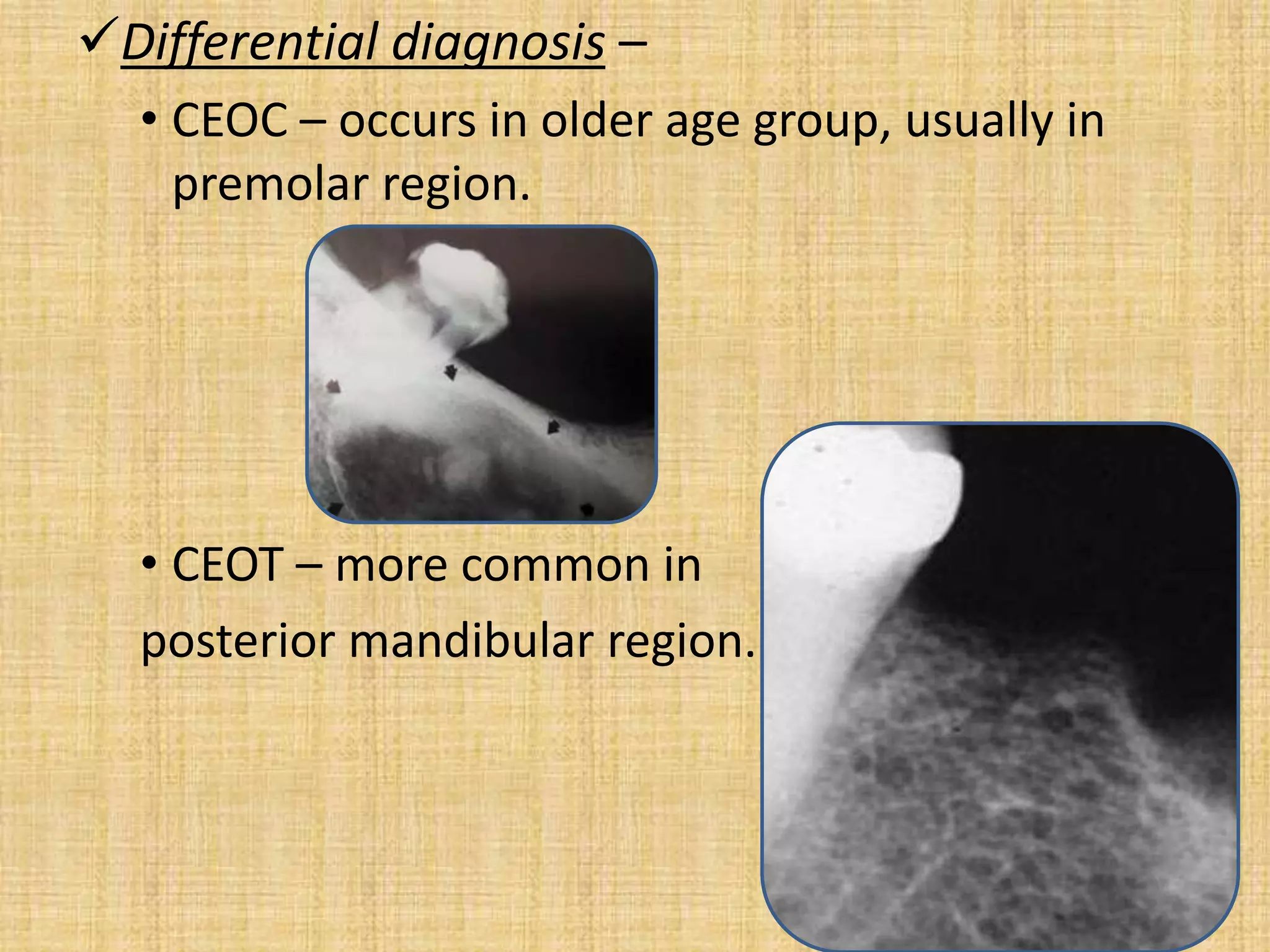Mixed radiopaque & radiolucent lesions | PPTX