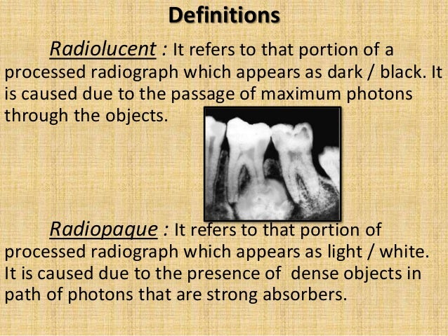 Mixed radiopaque & radiolucent lesions