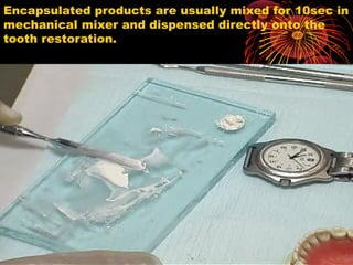 Mixing techniques of five dental products | PPT