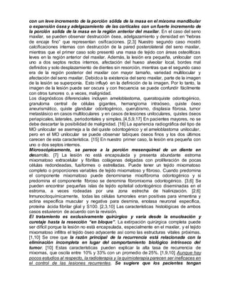 MIXOMA ODONTOGENICO DEL MAXILAR: DISCUSION Y REVISION CON DOS REPORTES ...
