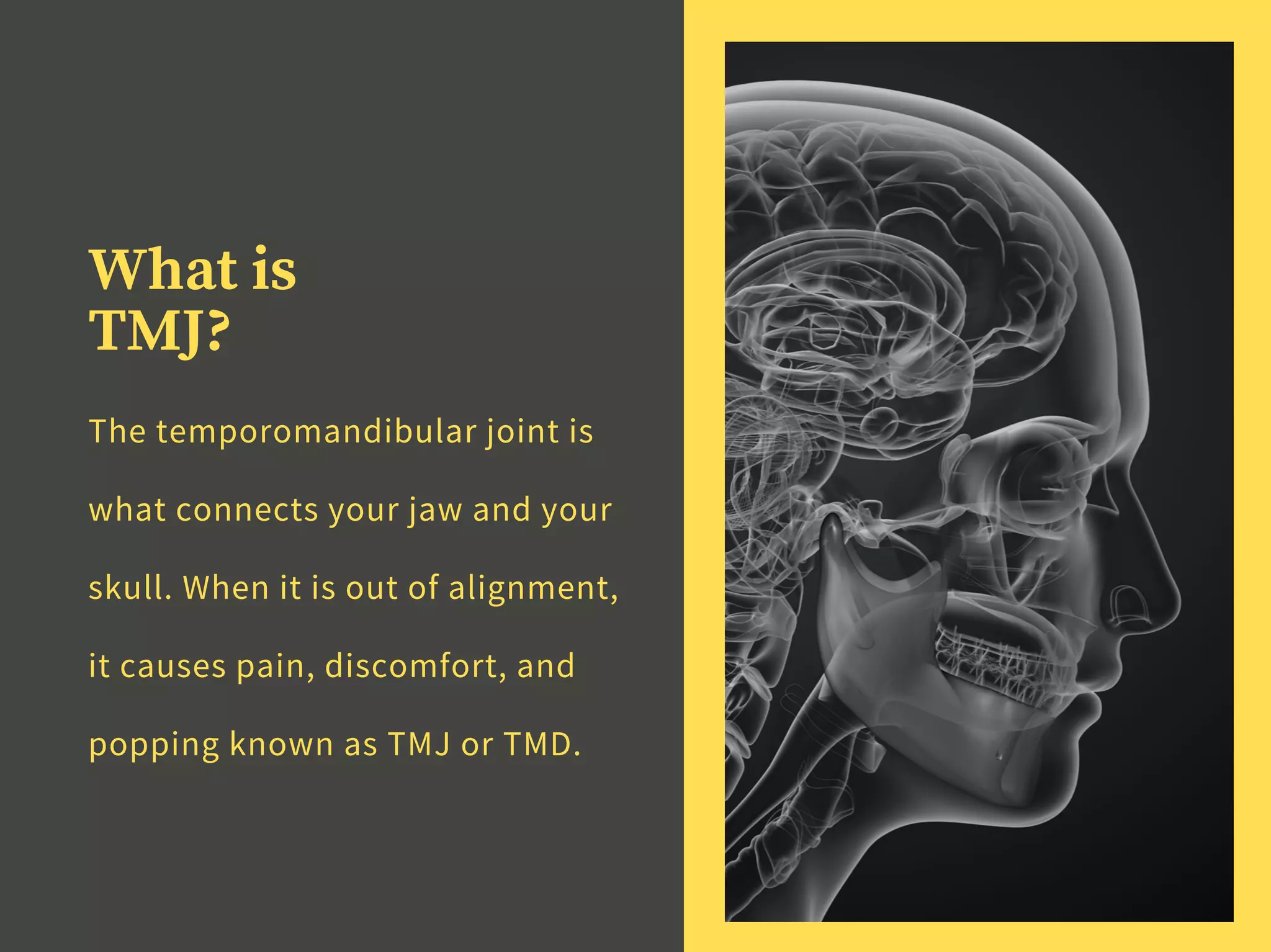 TMJ Treatment | PPT
